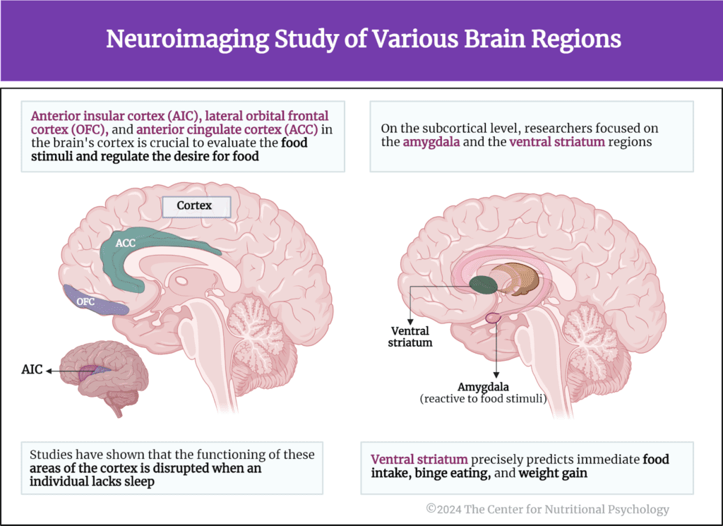 Does Lack of Sleep Dysregulate Parts of Our Brain that Control Appetite?