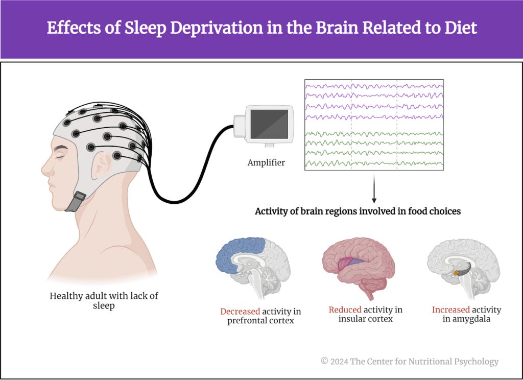 Does sleep duration affect how much fruit and vegetables we eat? - The ...